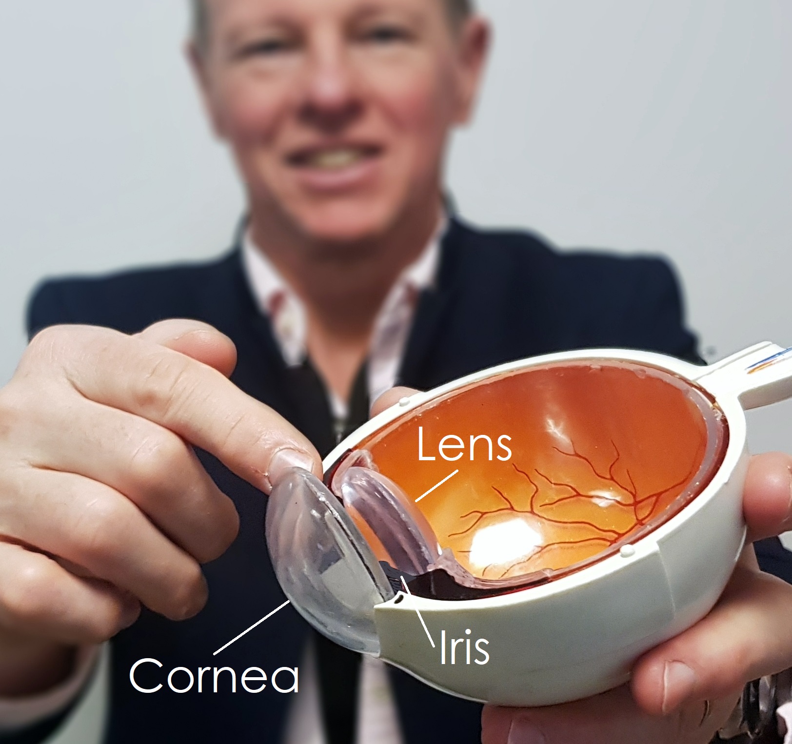Eye Lens Replacement Surgery: Refractive Lens Exchange