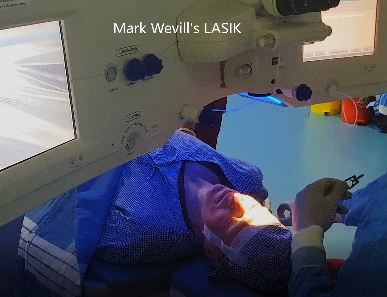 Do LASIK surgeons have LASIK themselves? Short answer: yes